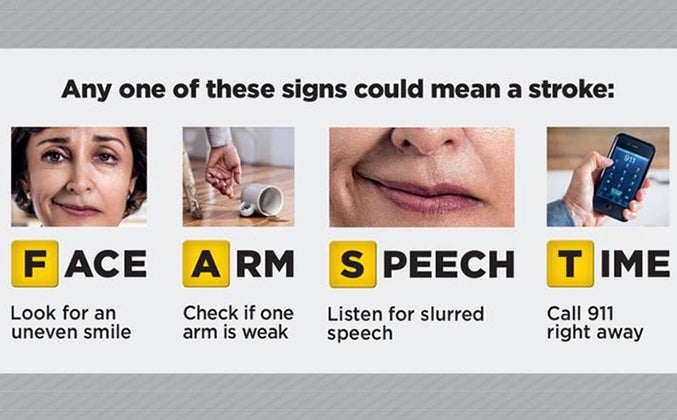 Stroke Face Symptoms